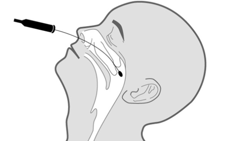 COVID-19 testing site utilizes new self-swab method - Dallas Voice